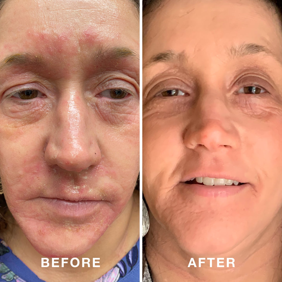 Kindness Powered Skincare - Kind to Skin, the Planet, and Others