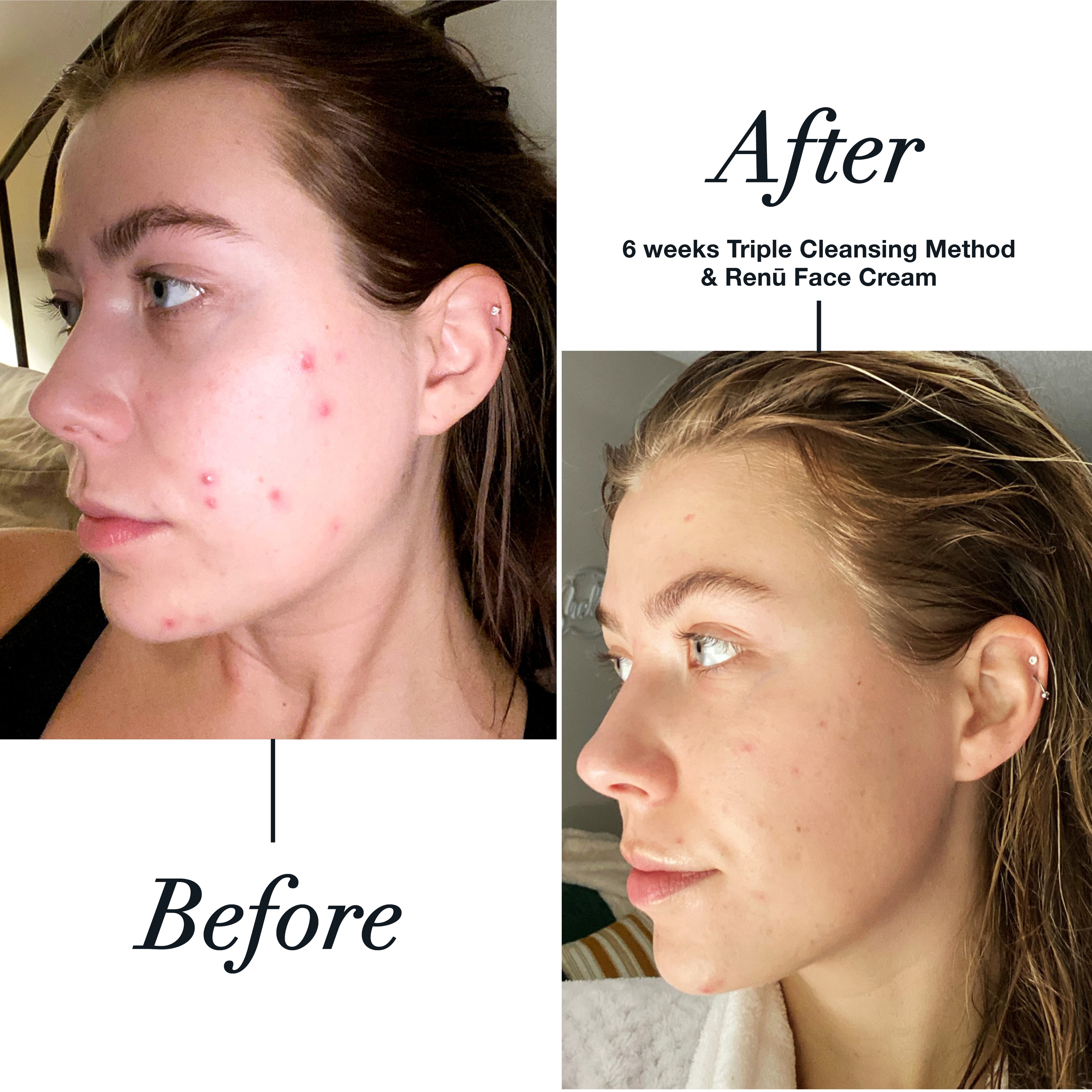 KPS Essentials | Kindness Powered Skincare