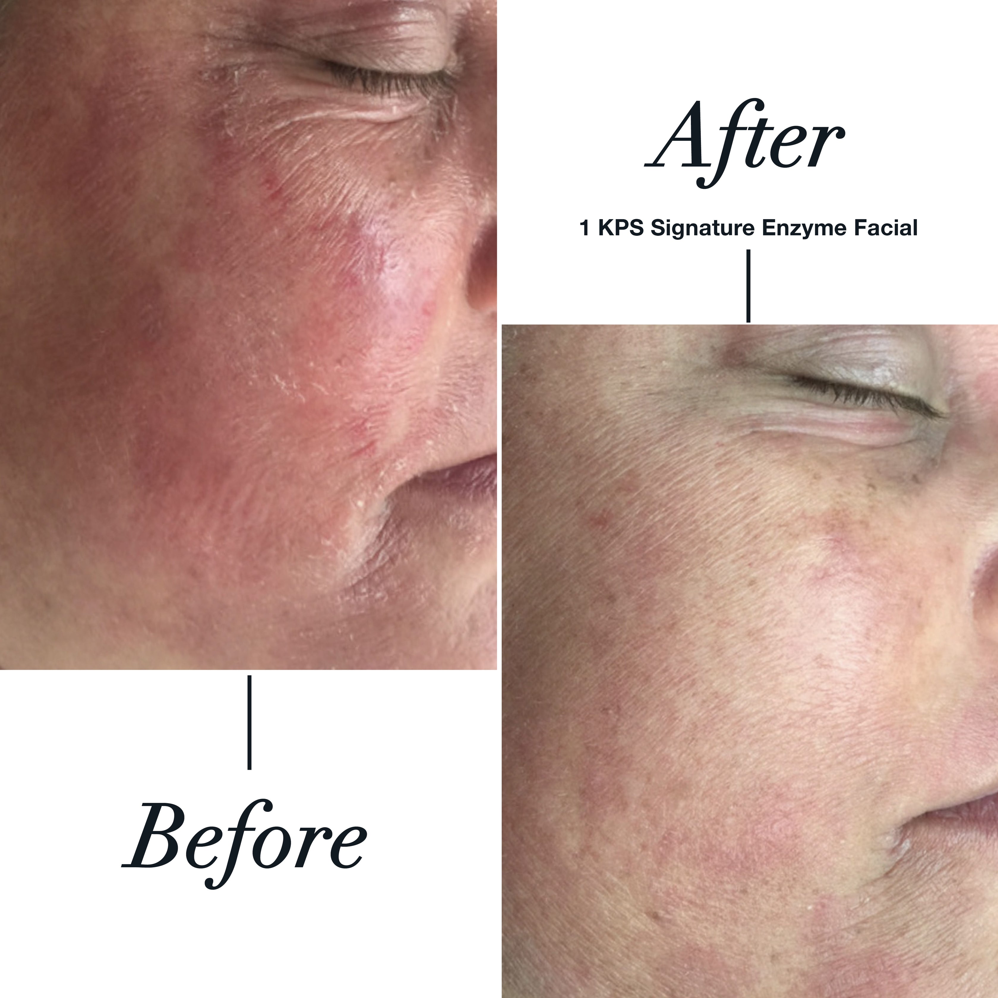 before and afters – Kindness Powered Skincare